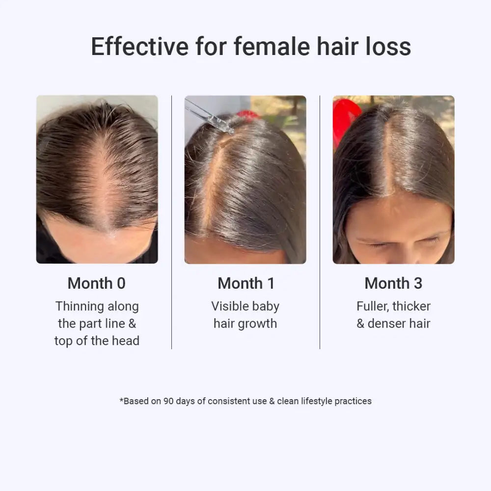 Intensive Hair Growth Serum for Fuller, Denser, Thicker Hair Growth – Arata