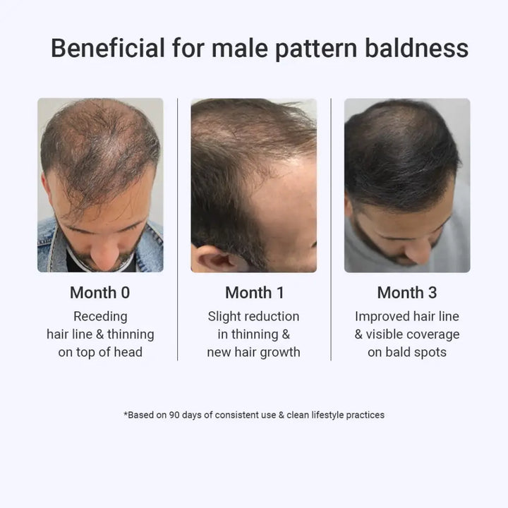 Intensive Hair Growth Serum | Derma Roller (FREE) – Arata